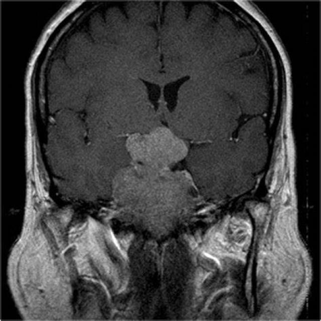Medical Image Classification Classification Model by Practicing