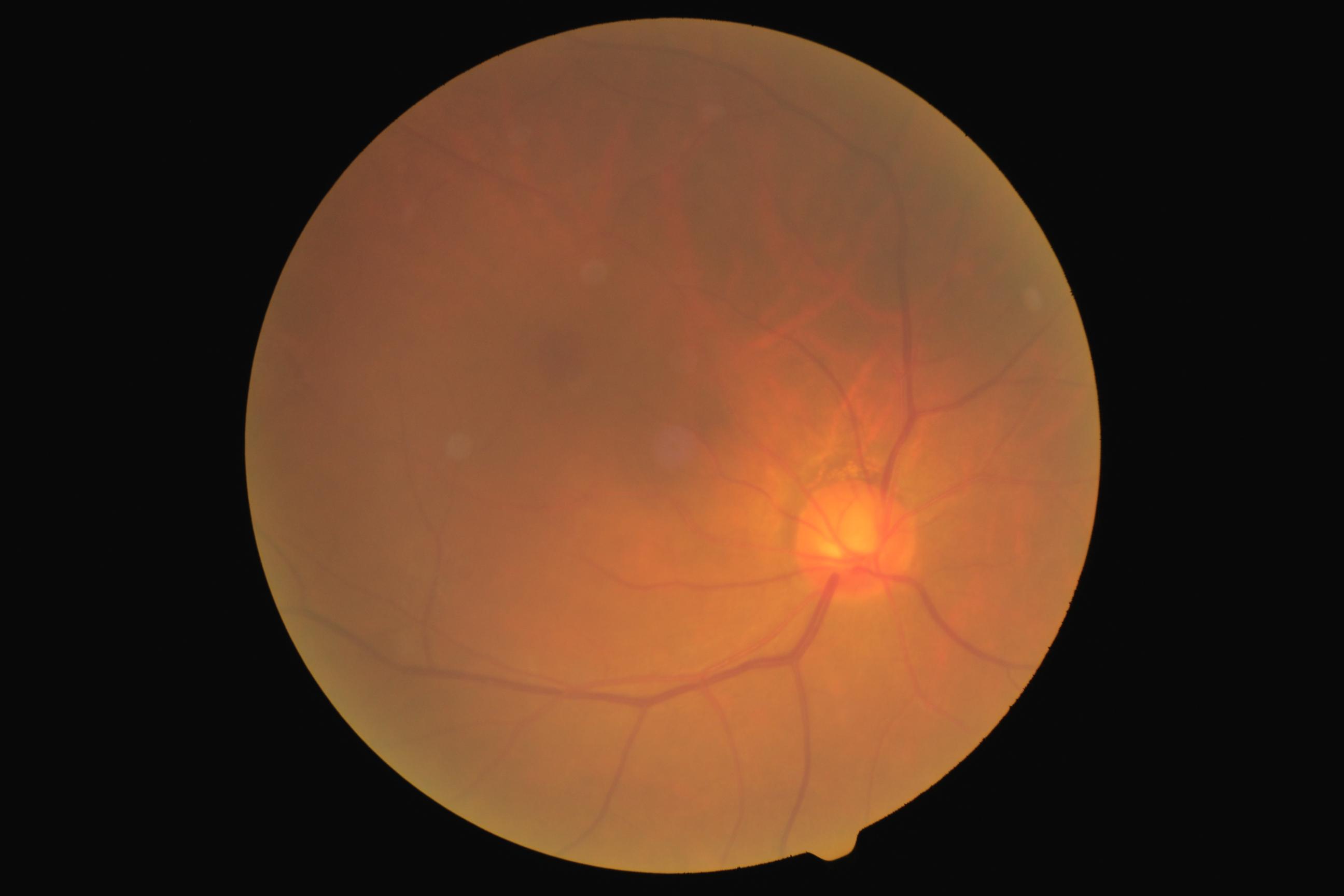 Segment Instance Segmentation Dataset by YOLO OBB
