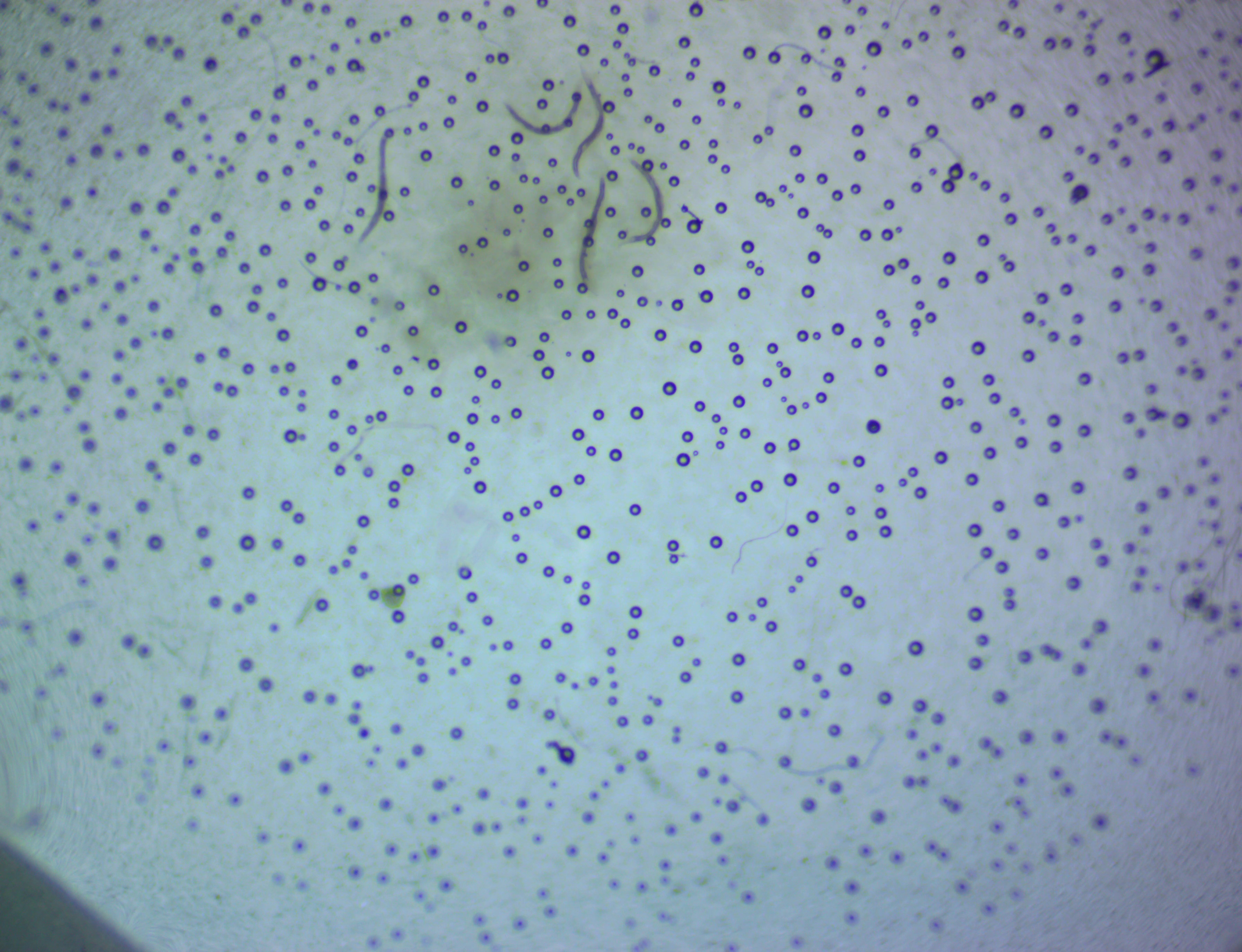 Caenorhabditis Elegans detection Object Detection Dataset and Pre-Trained Model by Worms