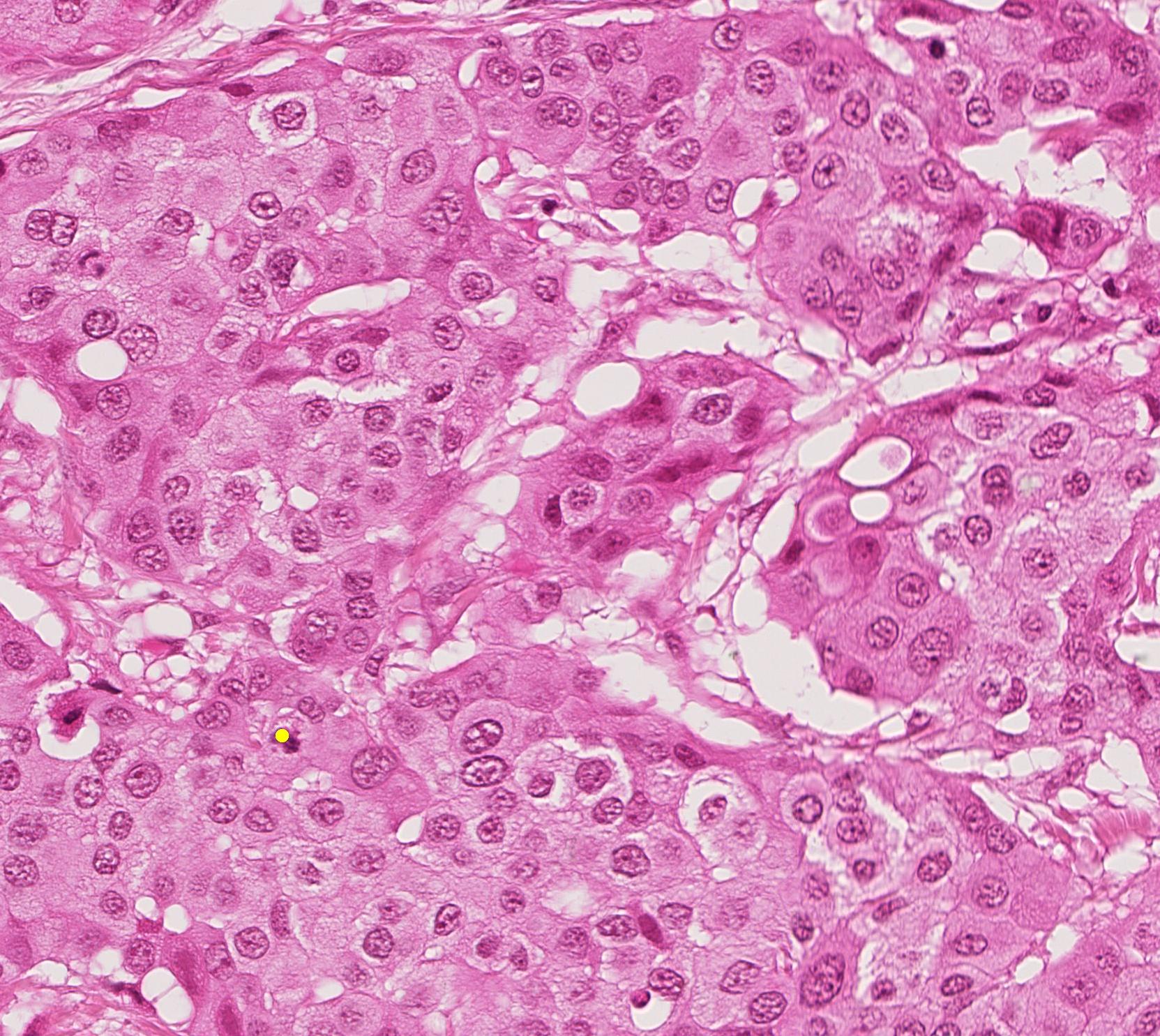 Mitosis Datasetnew Object Detection Dataset By Scale Sphere Solutions