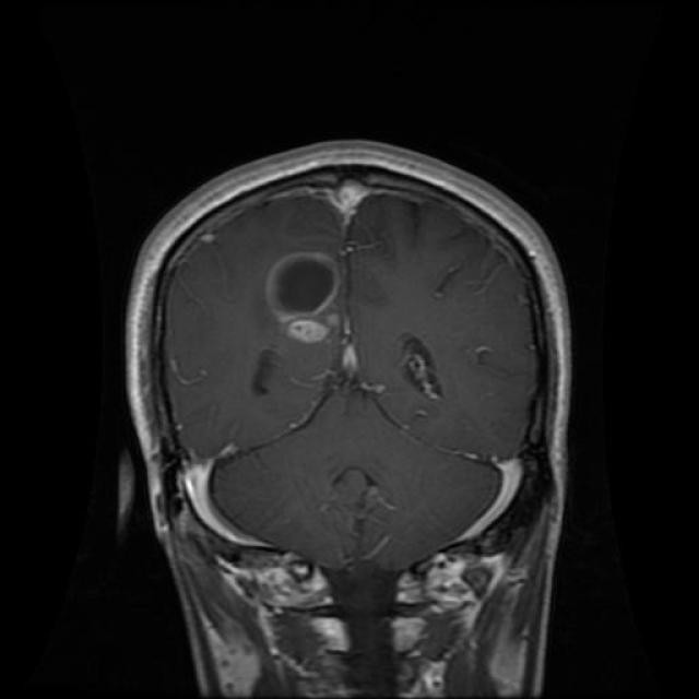 semantic-segmentation Object Detection Model by eliza