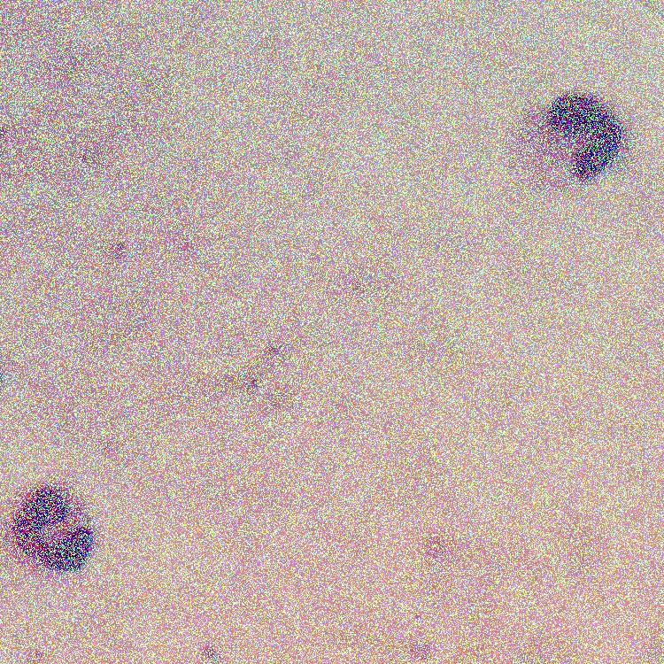 'Parasitized Malaria Cells' Object Detection Dataset and Pre-Trained Model by engbenard