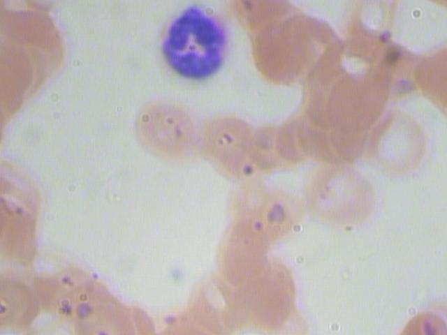 Tablets Object Detection Dataset and Pre-Trained Model by Mohammad Ali Jinnah University Karachi