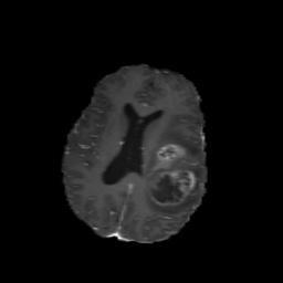 mri Object Detection Model by brainctscan