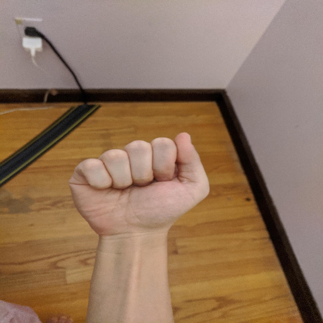 ACL Object Detection Dataset by MBD