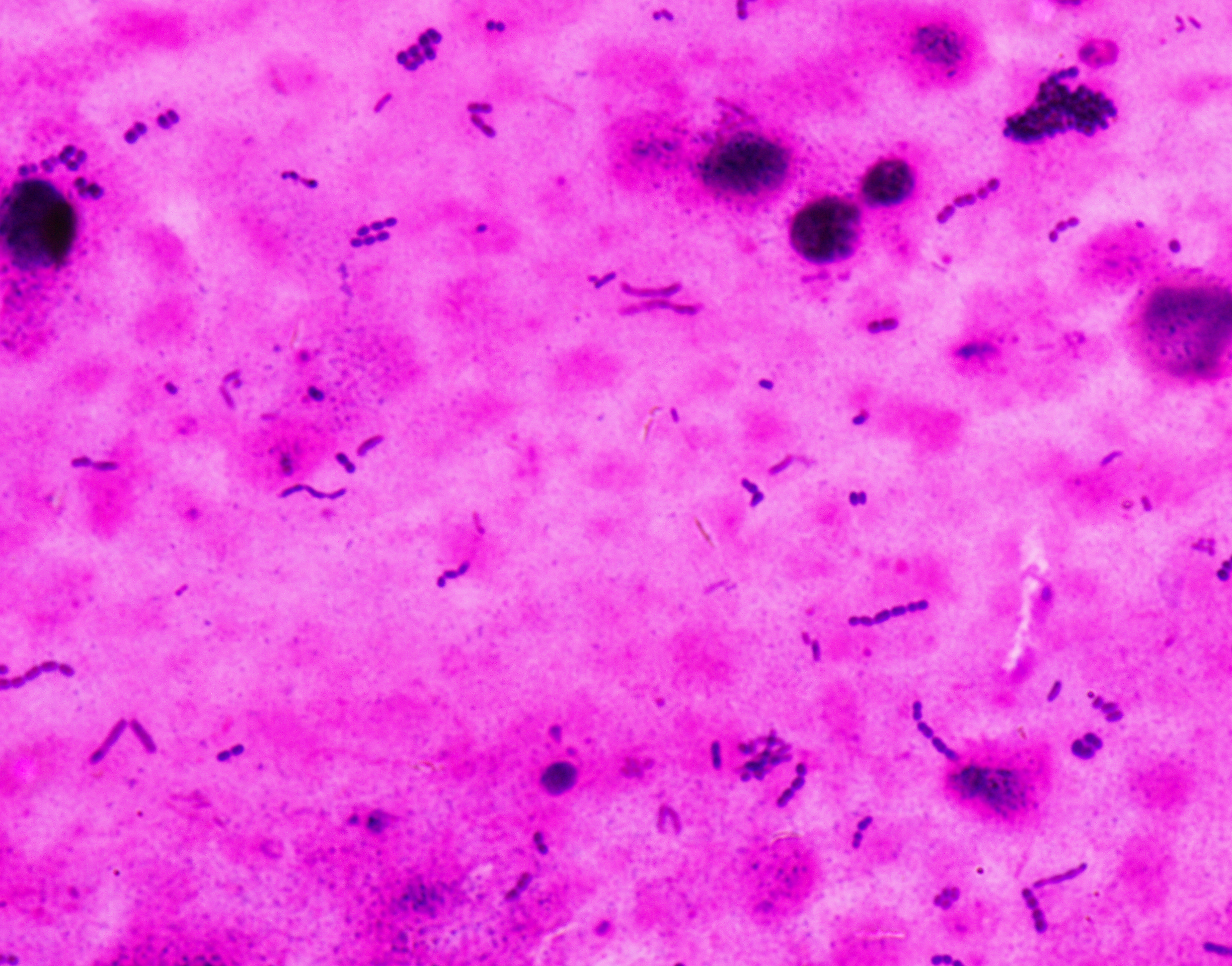 TB-gram-gray Object Detection Dataset by gramstain