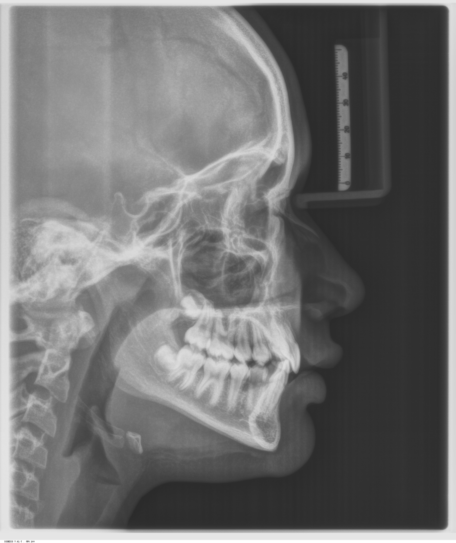 Arias Marco - Roboflow Universe