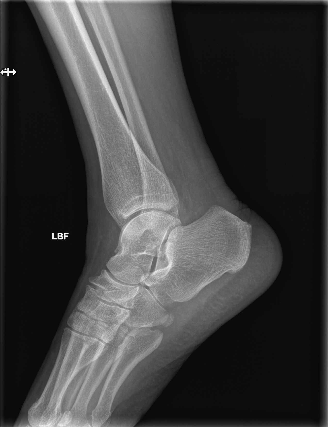 yolo Object Detection Model by yolo