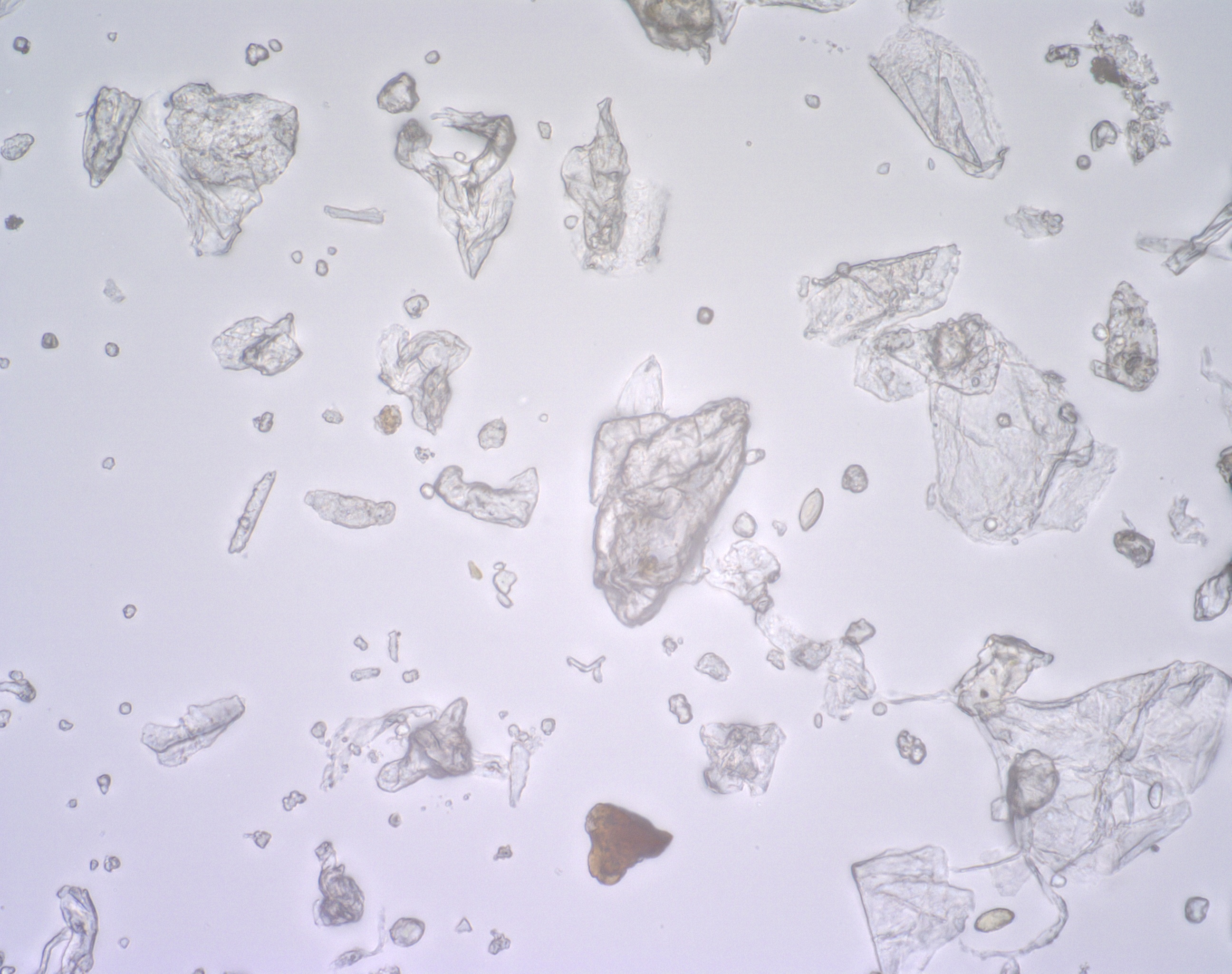 Workspace Test (workspace-test-jgkzz) - Roboflow Universe