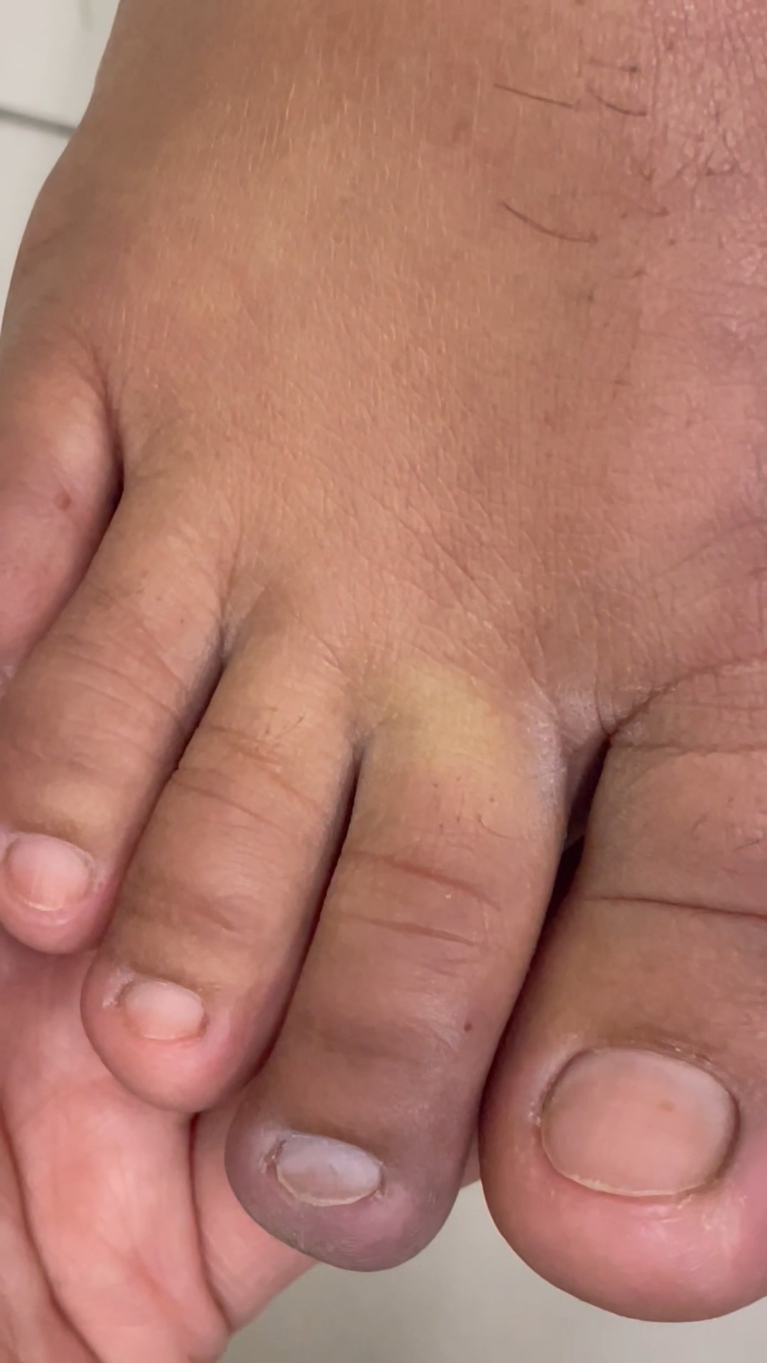 V5_2 Object Detection Dataset by ai skin data2