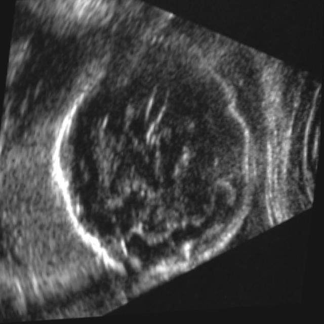 school (school-zdxi2) - Roboflow Universe