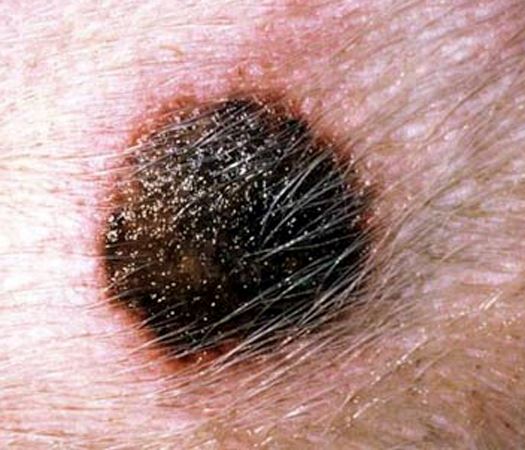 PIGING - Pig Disease Detector Object Detection Dataset and Pre-Trained Model by Robotics CTRL Freaks