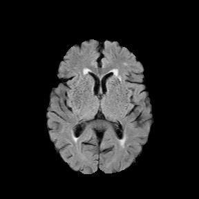 Brin MRI Object Detection Dataset and Pre-Trained Model by Raha