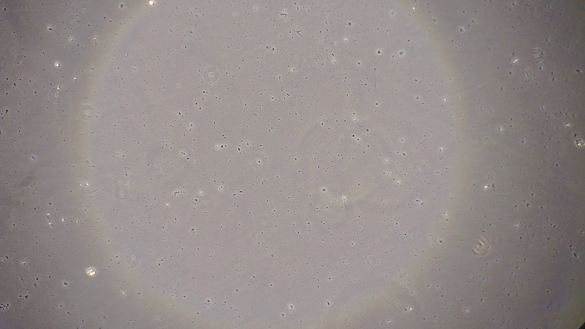 Sperm Segmantation Mobile Object Detection Dataset by BitirmeProjesi