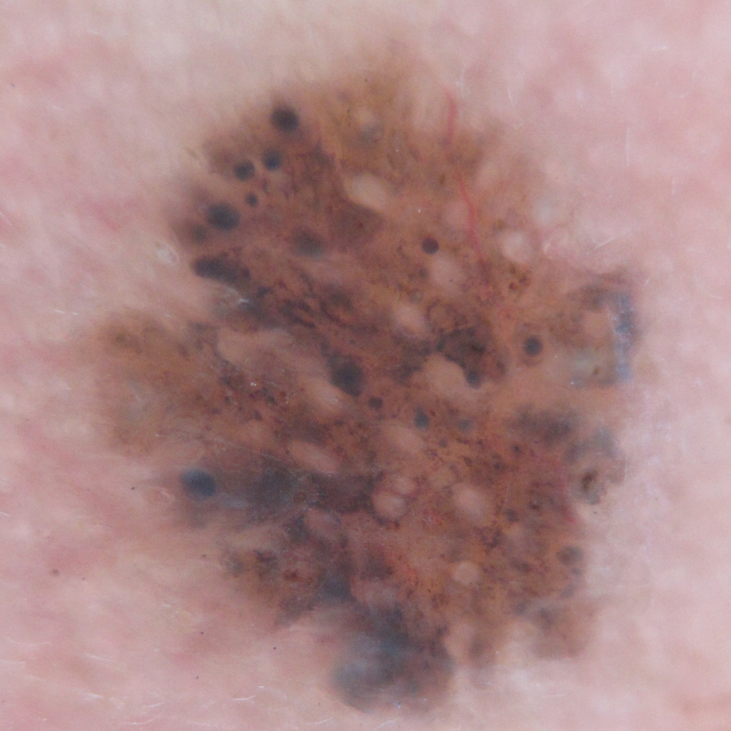 Data Augmentation Classification Dataset by Krrish