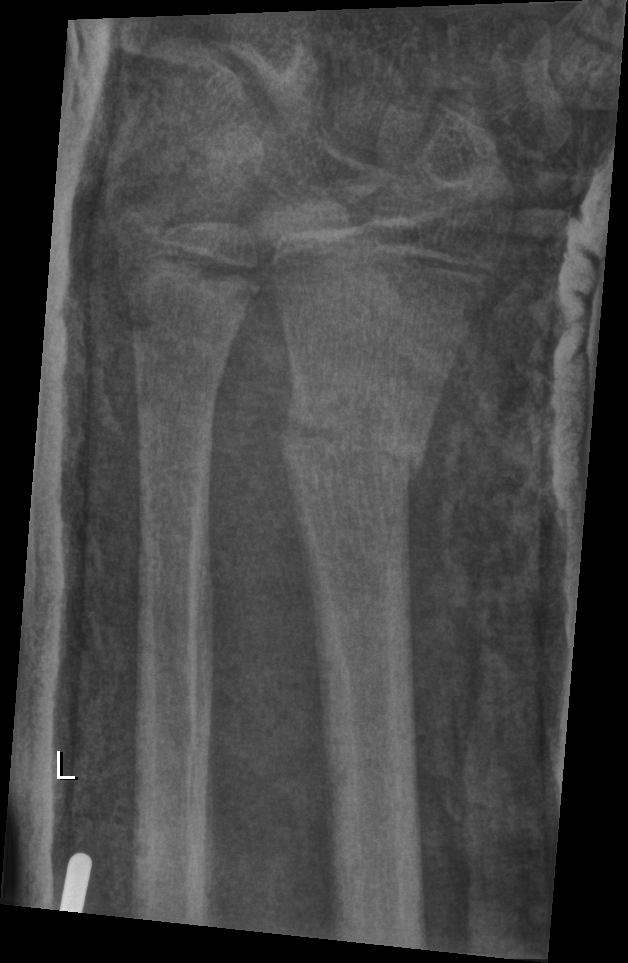 bone_detection_yolov11 Object Detection Model by TambahanTesis