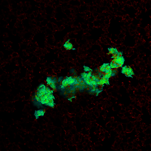 MP_tissue Instance Segmentation Dataset by MPtissue
