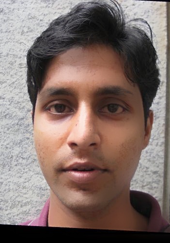 Acne Marks dataset Object Detection Dataset by Rizwan