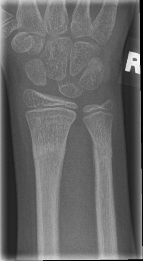 Nothing Object Detection Dataset by Artificial Intelligence