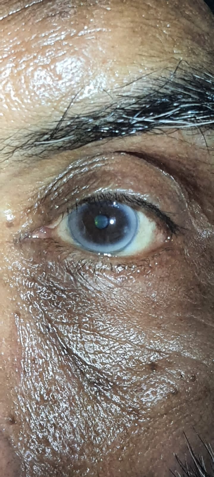 Ewan (ewan-djn6t) - Roboflow Universe