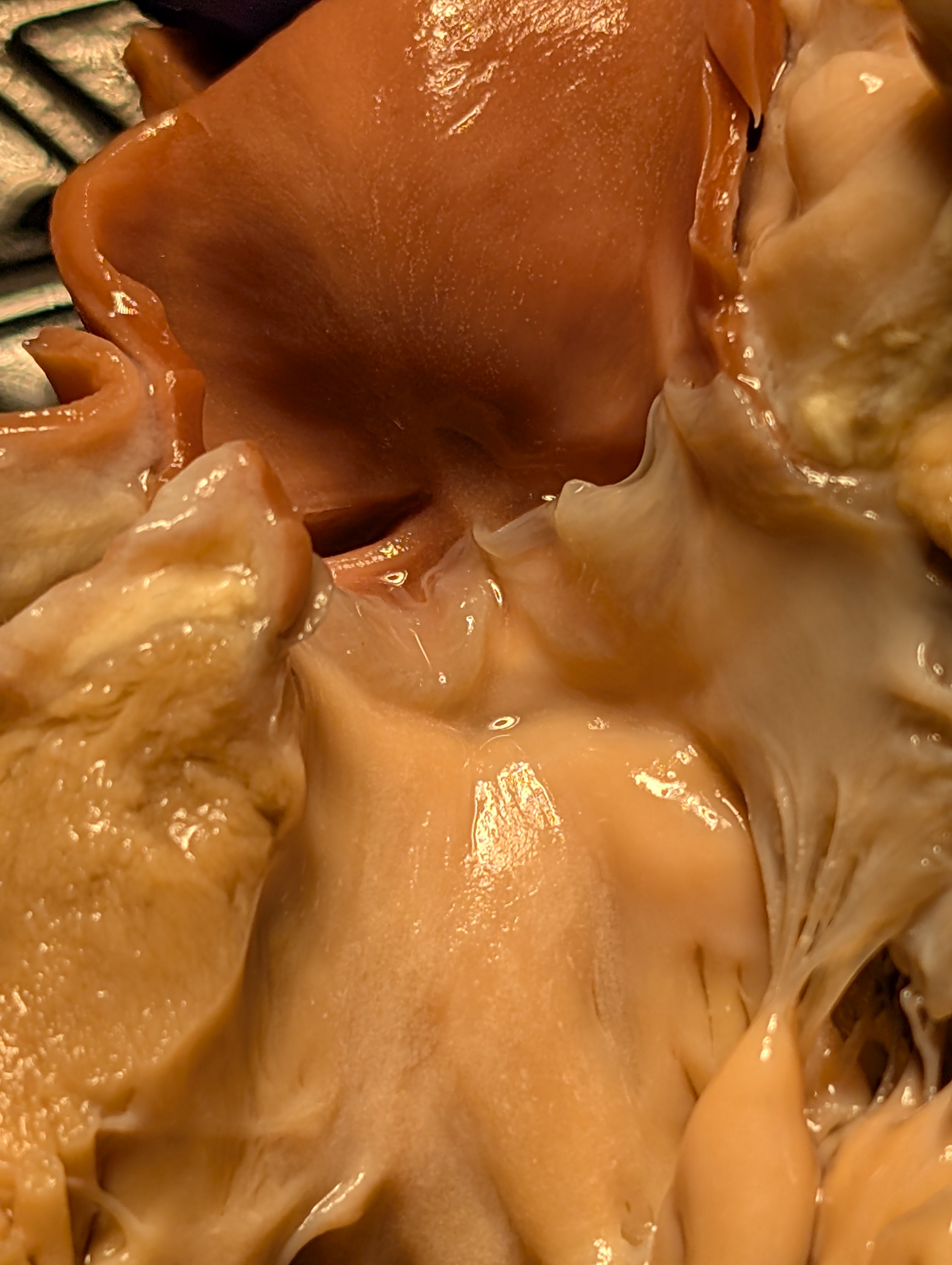 Heart Specimen Object Detection Dataset And Pre Trained Model By Heart Specimen