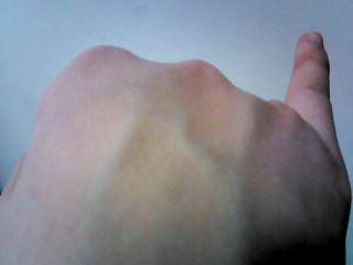 HAND Classification Dataset by Jingru Guo