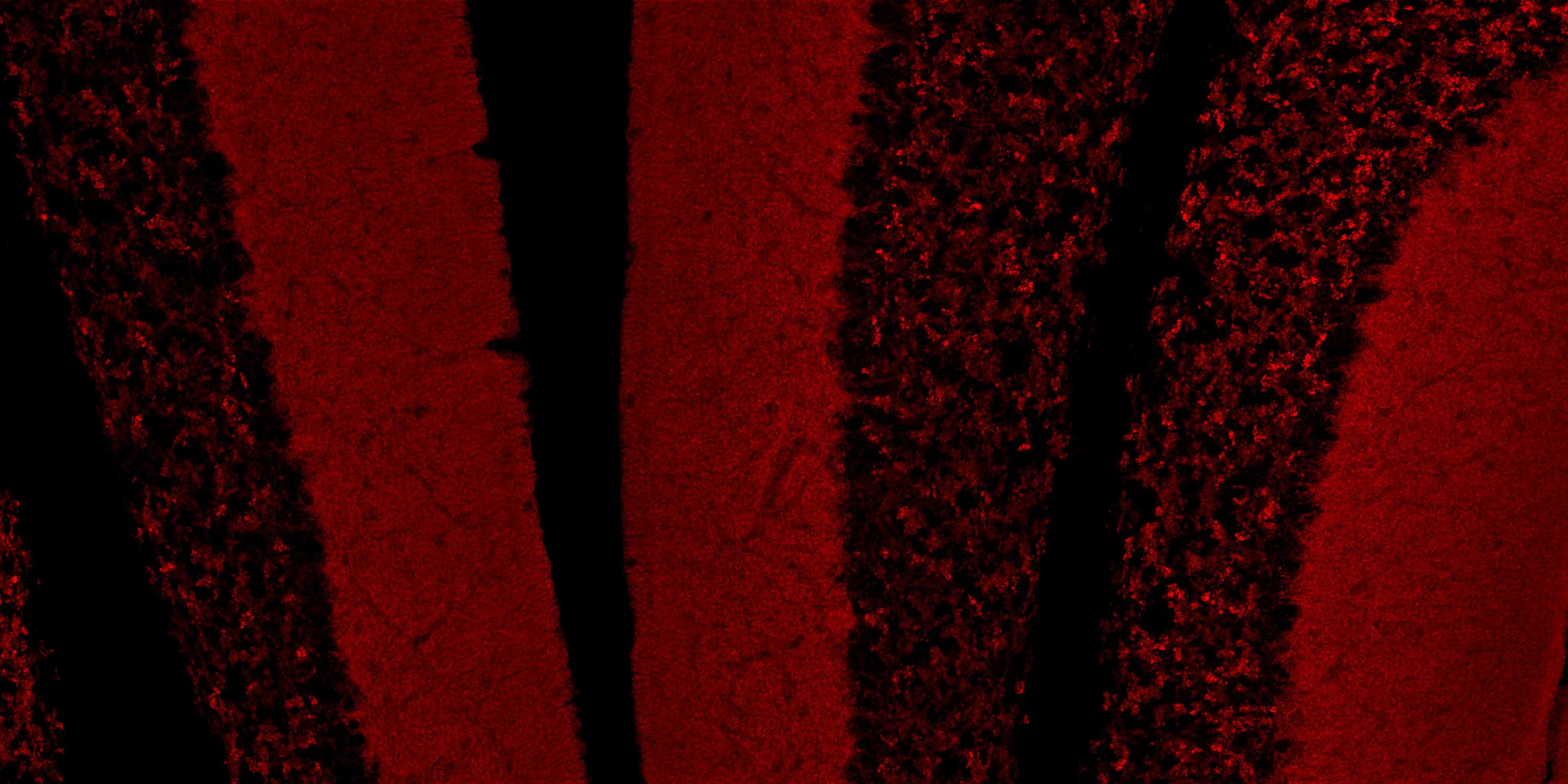 Final Project 50 Images Instance Segmentation Model by Annotations in PNG