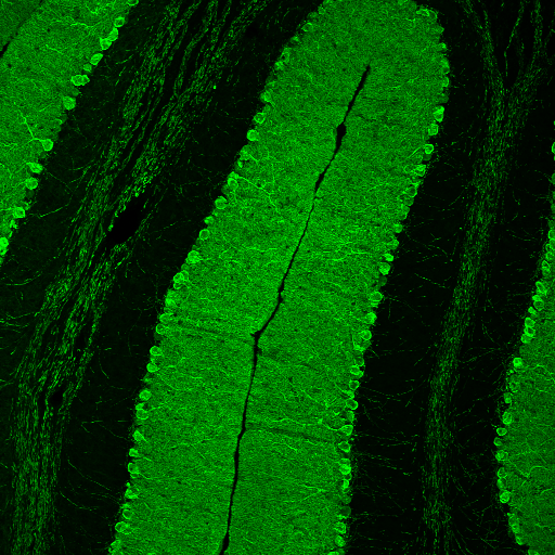 Project with 47 files Instance Segmentation Dataset and Pre-Trained Model by Annotations in PNG