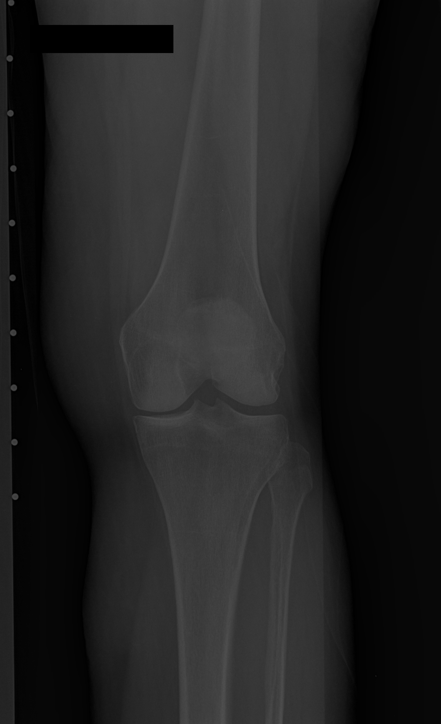 Knee Xray Object Detection Dataset And Pre Trained Model By Shin