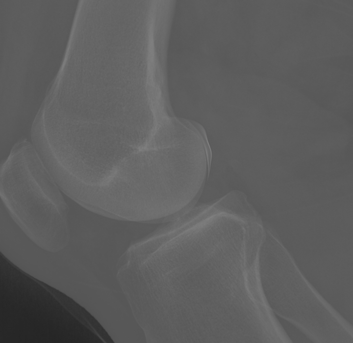 X_ray_Knee_pose_detection Keypoint Detection Model by shin