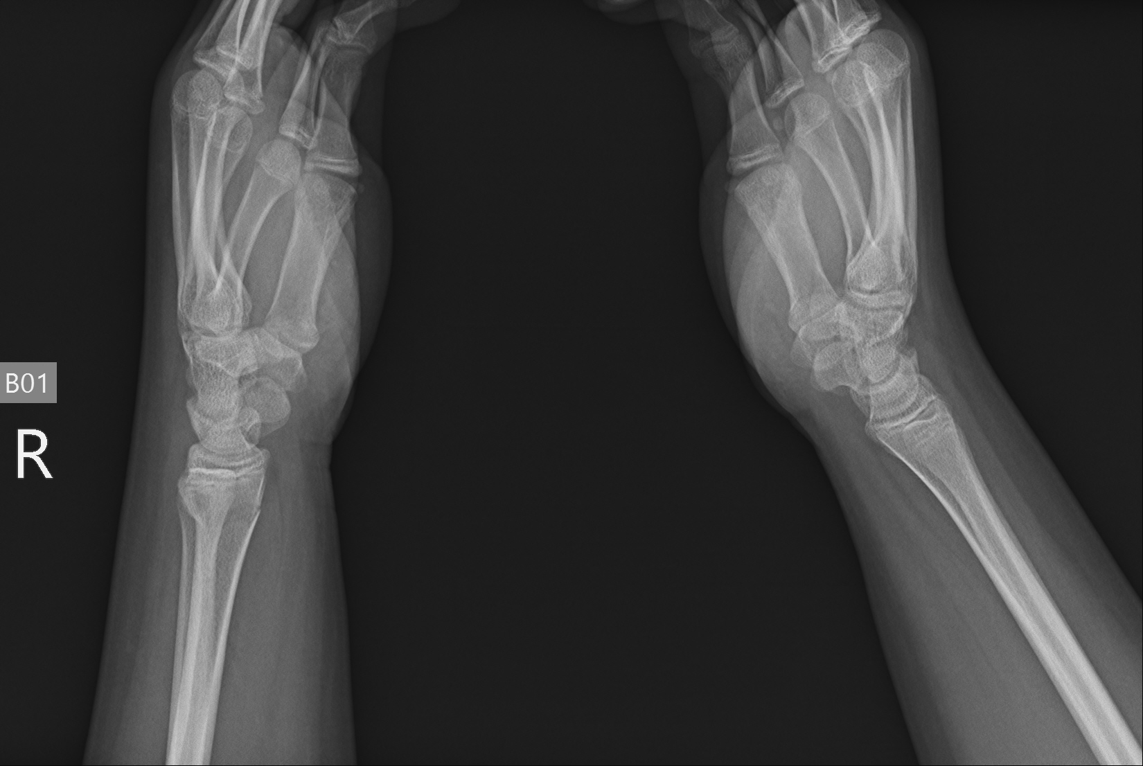 mksnm3 Object Detection Dataset by ssb