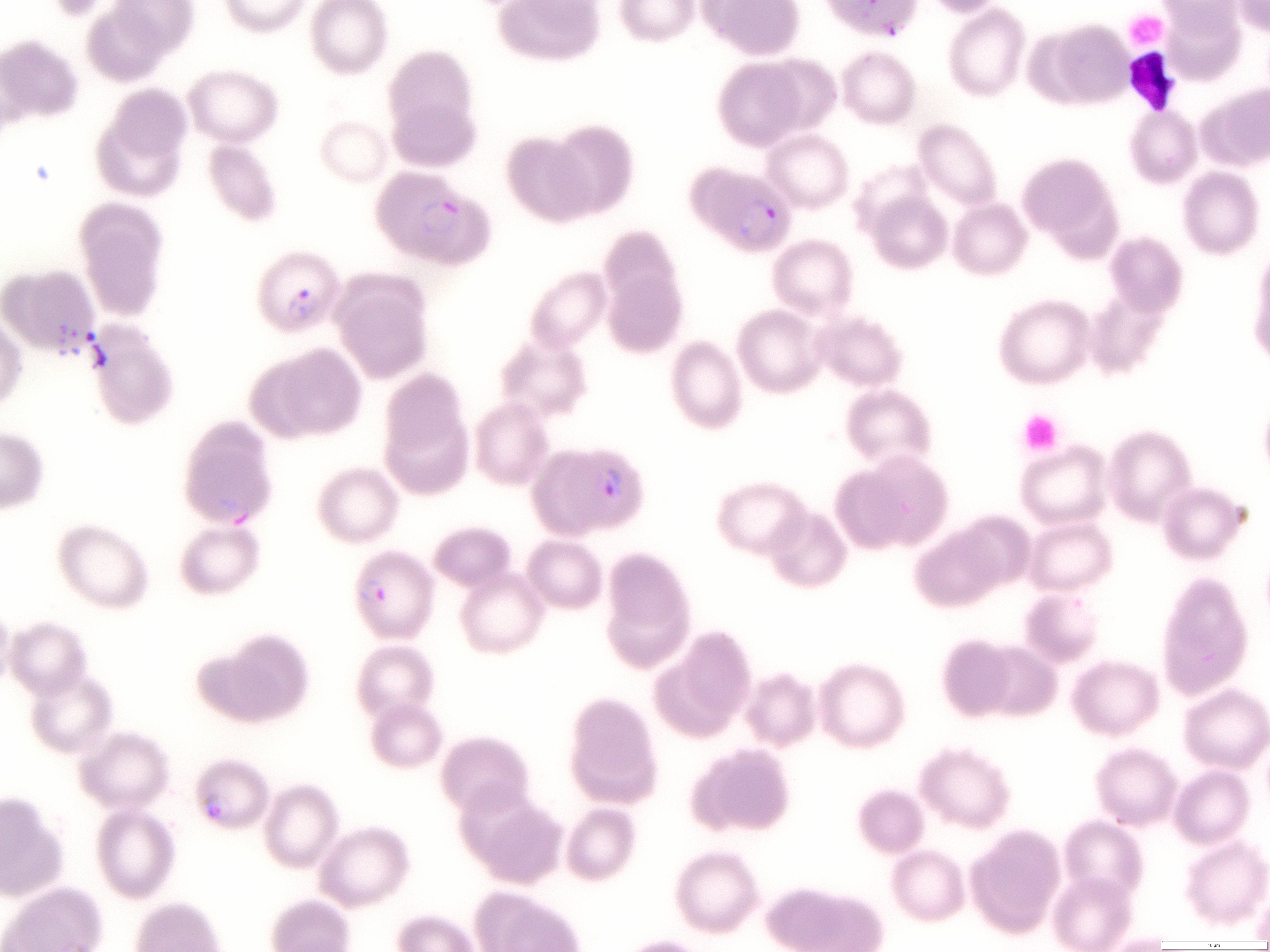 How to Use the Malaria Object Detection API