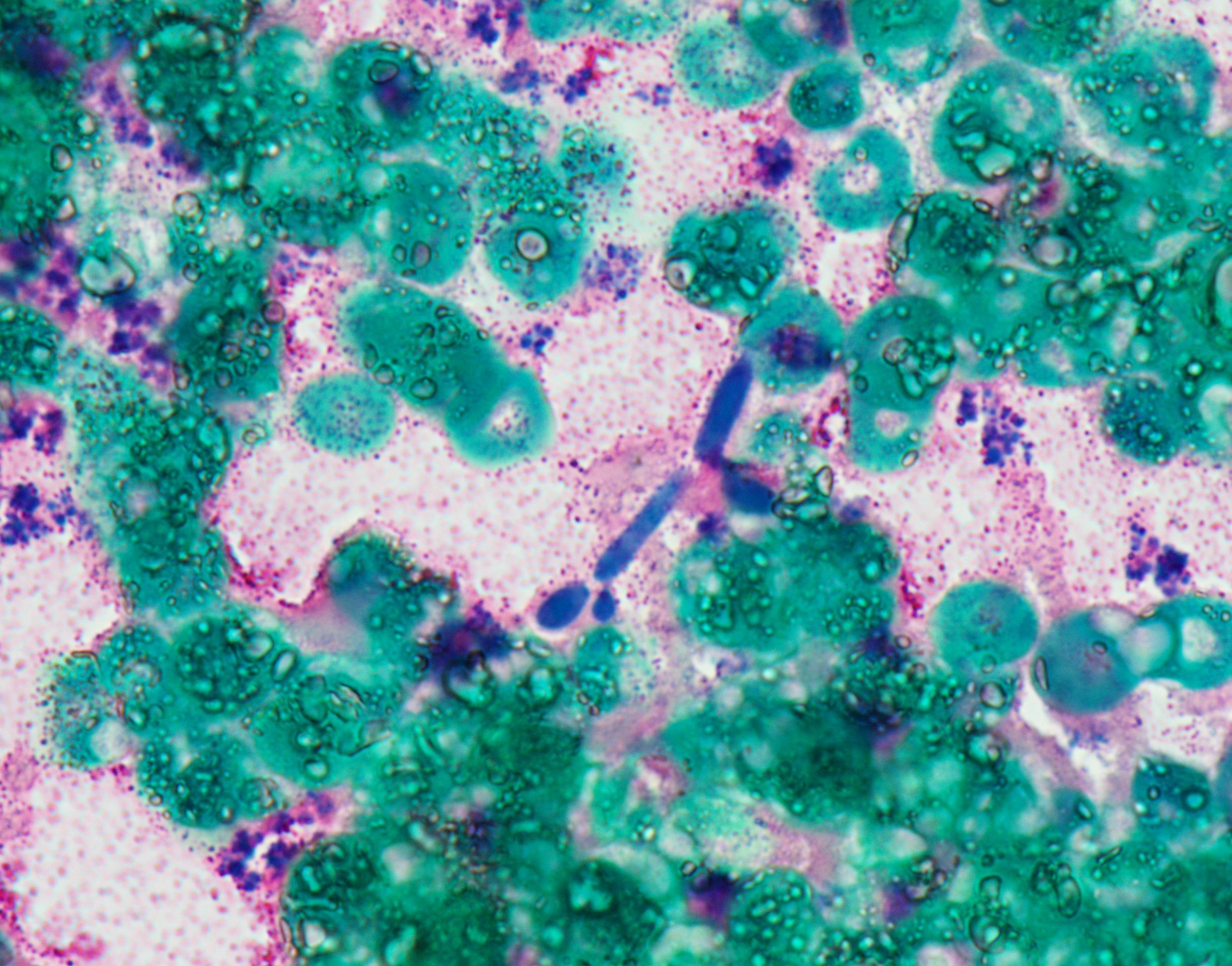 Candida Object Detection Dataset by Yeast2