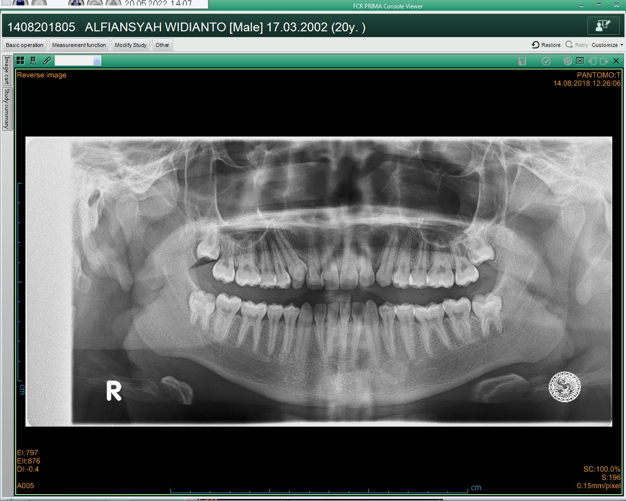 nasy (nasy-vqev9) - Roboflow Universe