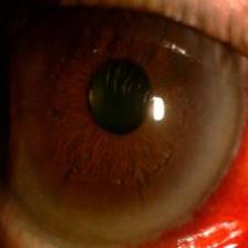 Iris y Pupila - CCCN4.0 Object Detection Dataset by PupiUp