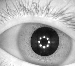 iris-images1 Object Detection Dataset and Pre-Trained Model by raghulbiometrics