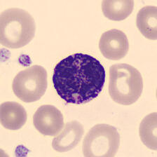 classification of WBC Object Detection Dataset and Pre-Trained Model by Home