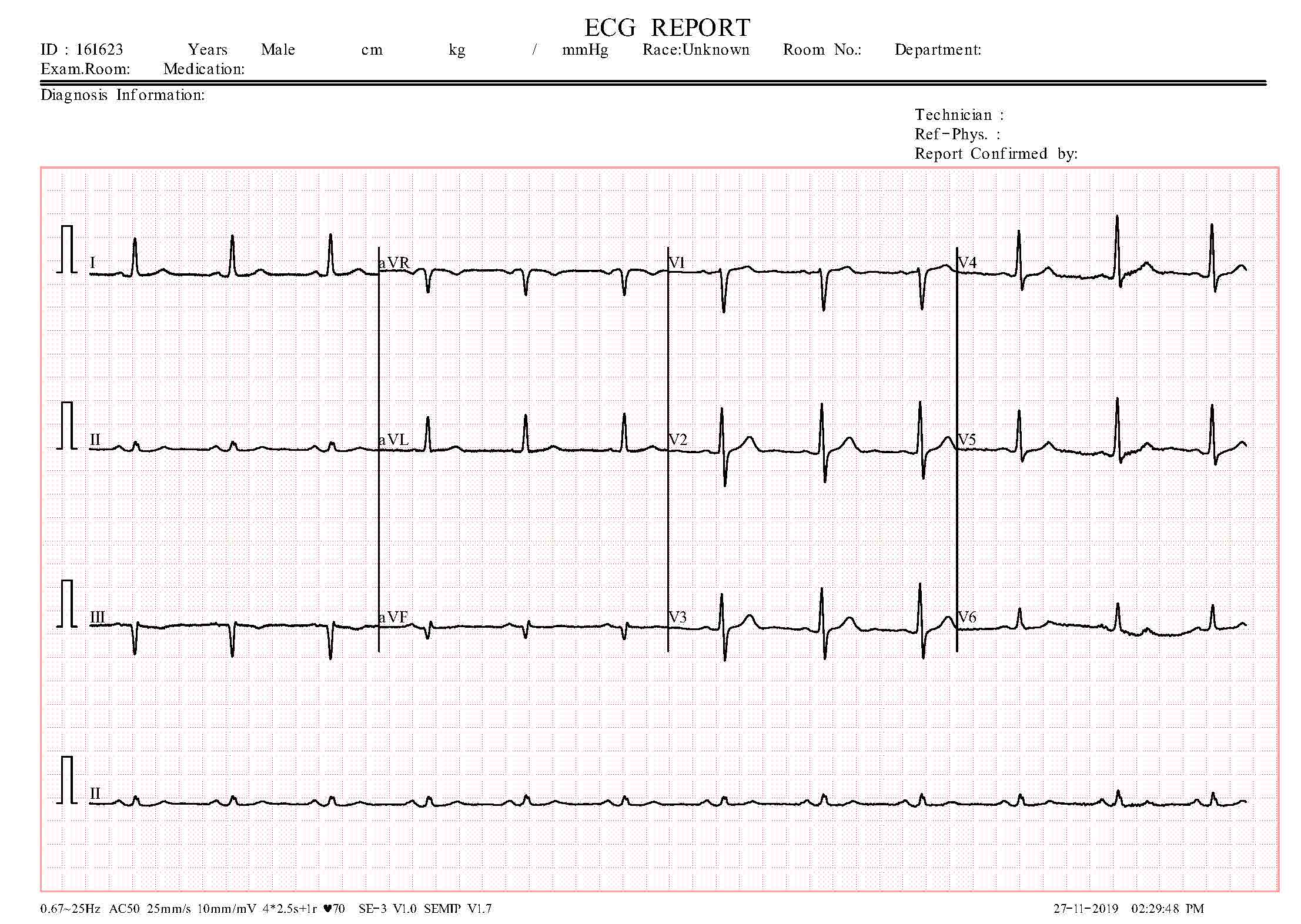 Ecg Lead Classification Object Detection Model By Ecg Annotation