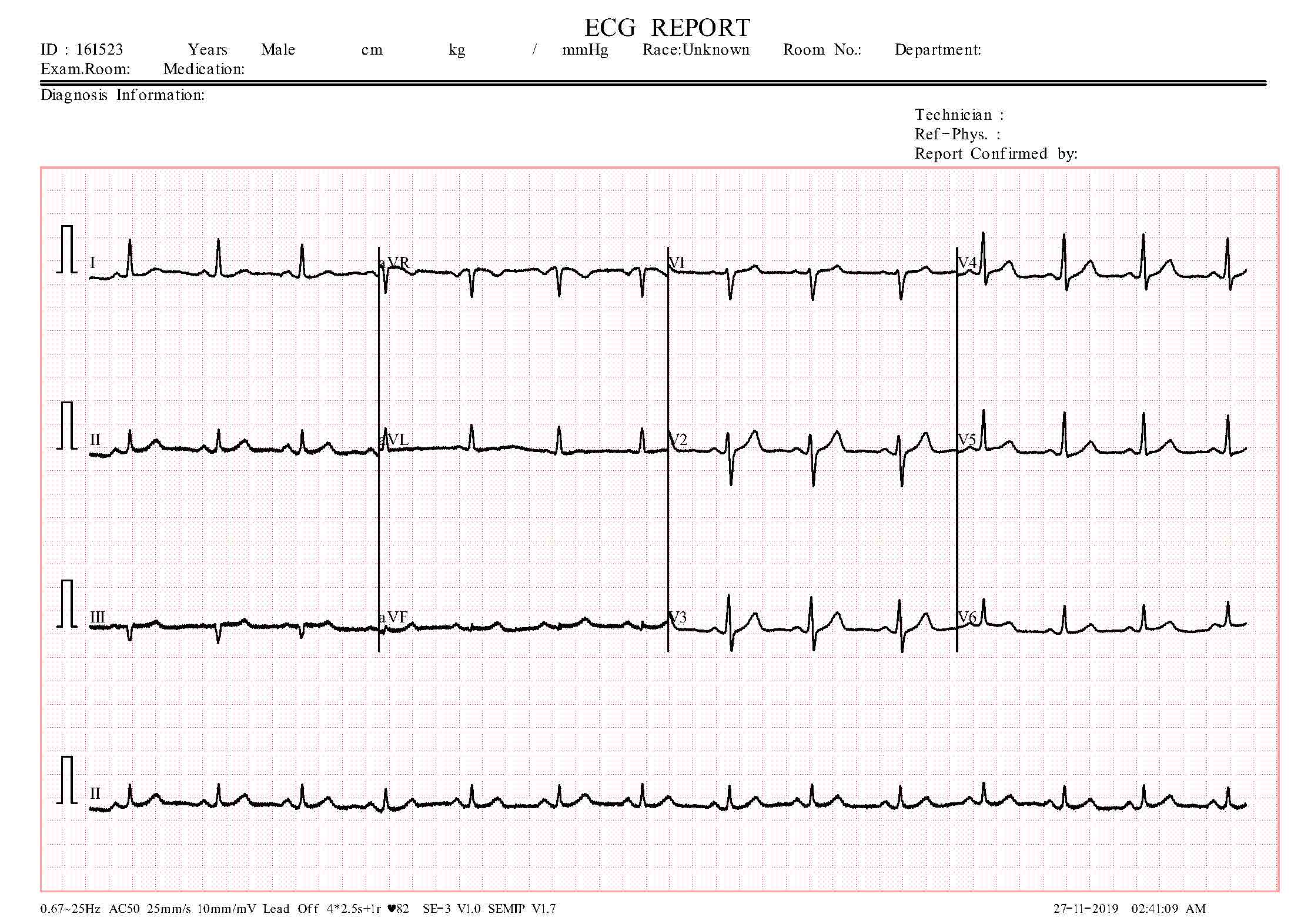 Ecg Lead Classification Object Detection Dataset V1 2024 01 25 3 14pm