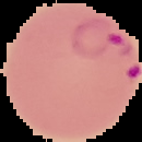 Malaria Object Detection Dataset by RIN