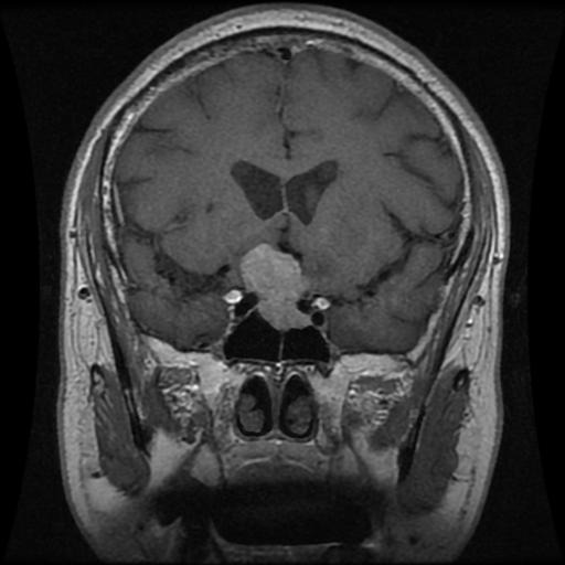 Brain detection Classification Dataset by Brain Tumor classification