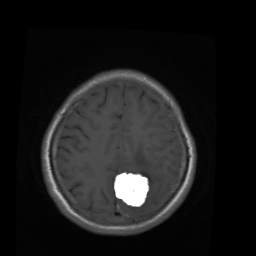 BrainTumorFRCNN Object Detection Model by BrainTumor FRCNN