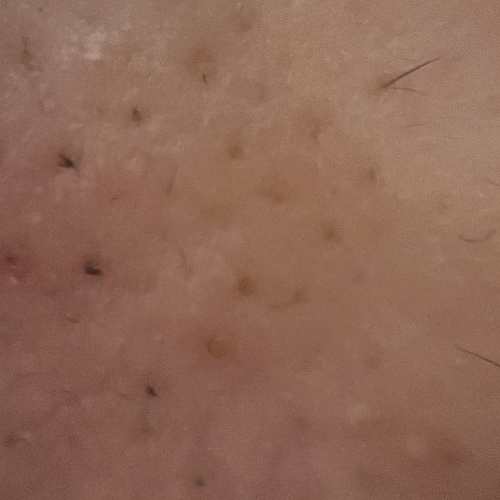 seg pore Instance Segmentation Model by sas