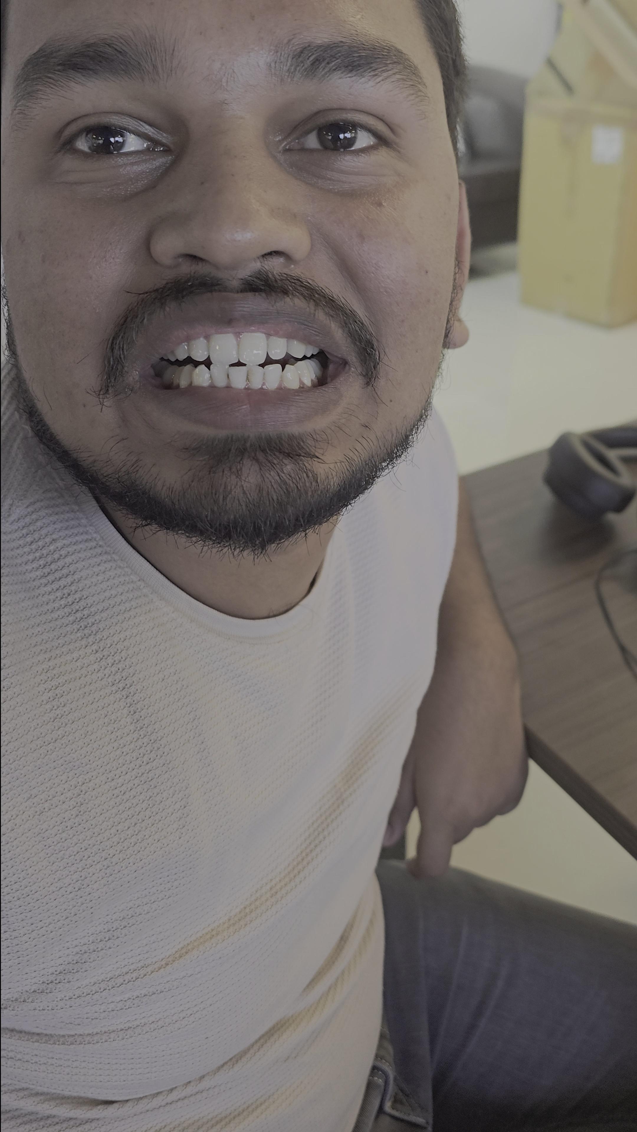 tooth Instance Segmentation Dataset and Pre-Trained Model by probleminlife