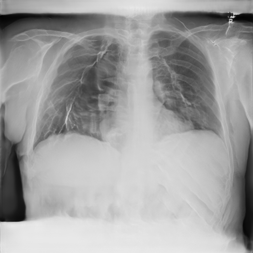 CXR (cxr-jsliy) - Roboflow Universe