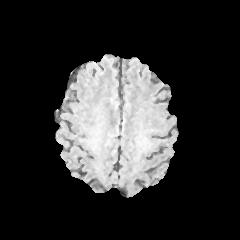 Brain Tumor Detection Object Detection Dataset by Happyaddi