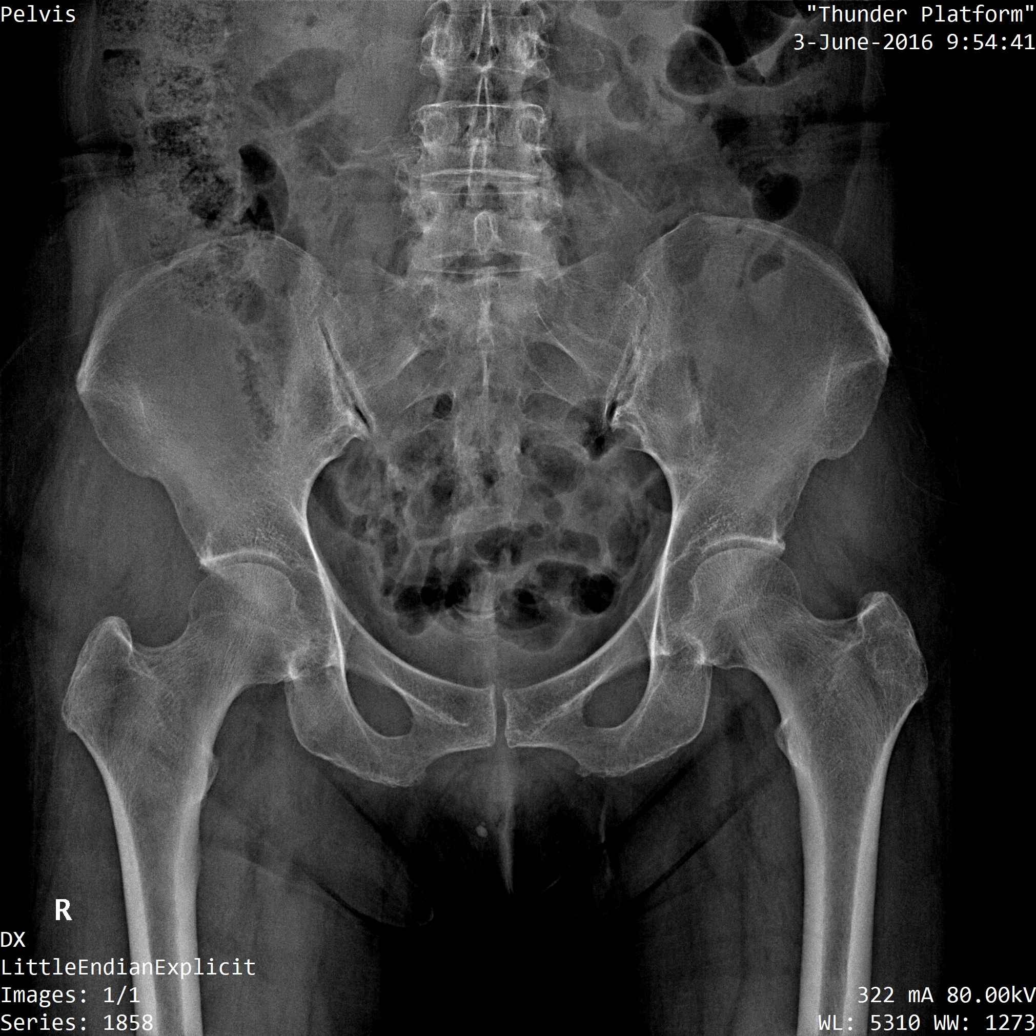 image classification eyes - Roboflow Universe