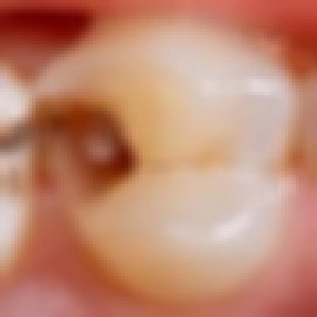 Tensorflow-Gauss 22 Object Detection Dataset by tt