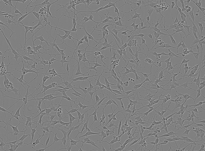 detect single neural cell in microscopic images Object Detection Dataset by Detect single cell ...