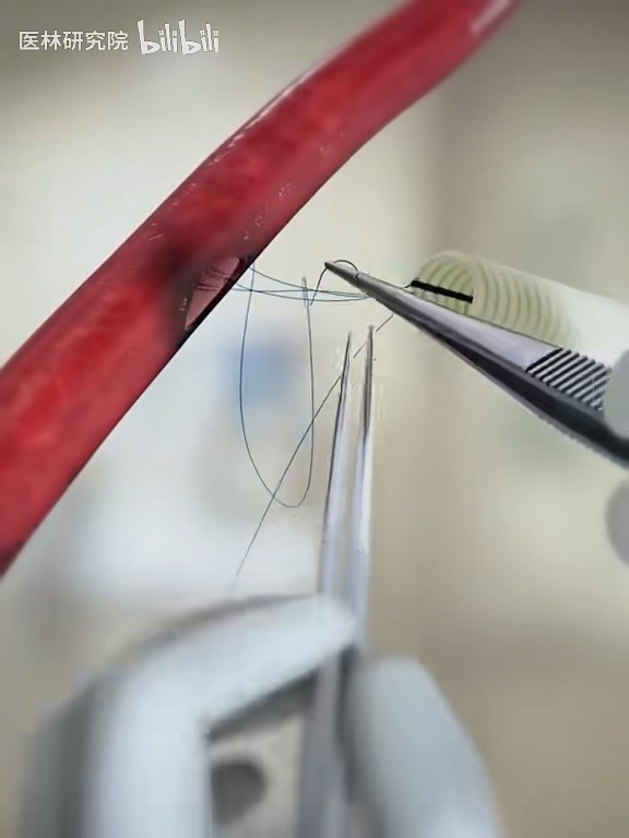 Surgical Needle Object Detection Model By Renji Hospital